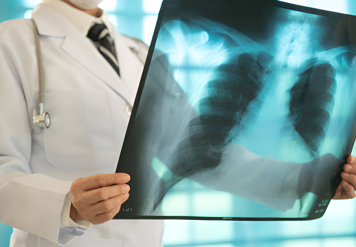 X-Rays - Hope Primary & Urgent Care